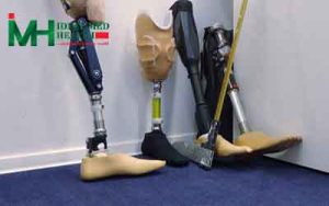 Top 10 Prosthetic Companies - idealmedhealth